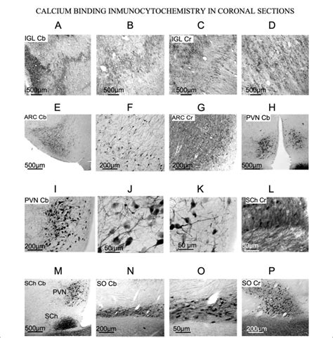 Figure Calcium Binding Protein Immunoreactivity Of The Nuclei Of