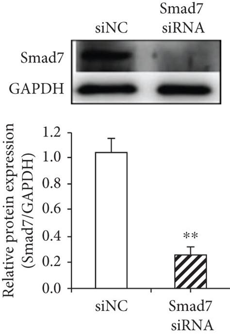 Mir 216a Enhanced Endothelial Inflammation Via Smad7 Iκbα Pathway A