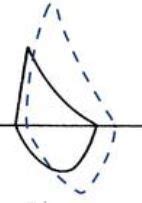 Exam 2 Asthma Flashcards Quizlet