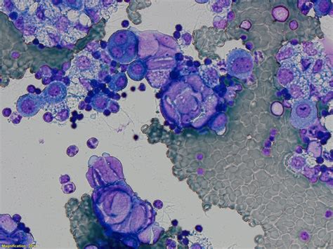 How Long Can A Dog Live With Untreated Mast Cell Cancer