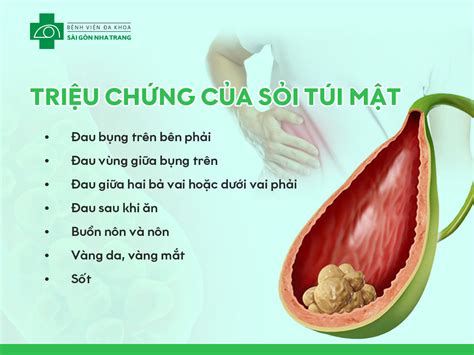 Giải Đáp Câu Hỏi Thường Gặp Về Sỏi Mật Bệnh Viện Đa Khoa Sài Gòn Nha Trang