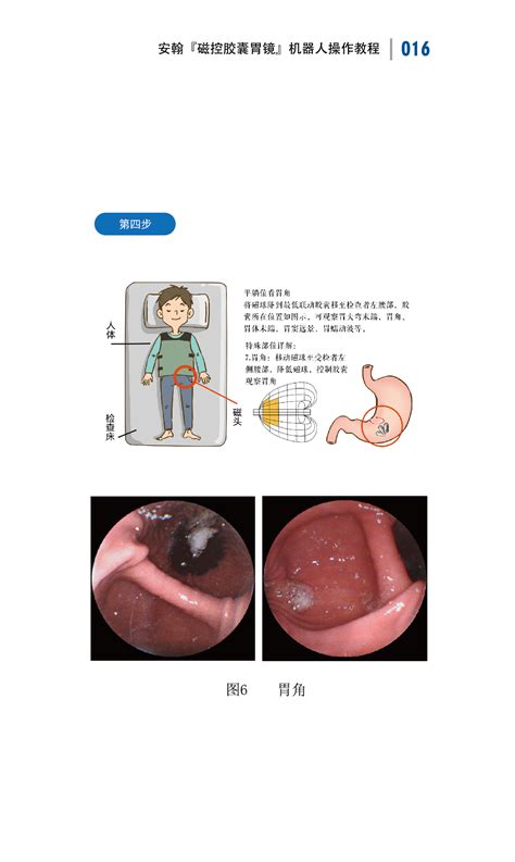 安翰官网 磁控胶囊胃镜系统 Ankon