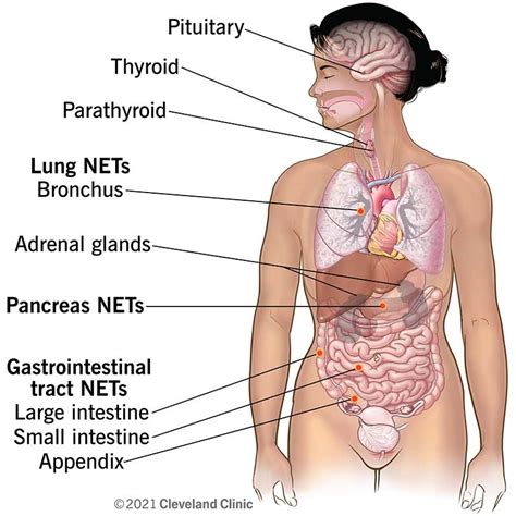 Neuroendocrine Tumor Diagnosis Symptoms Treatment And What It Is