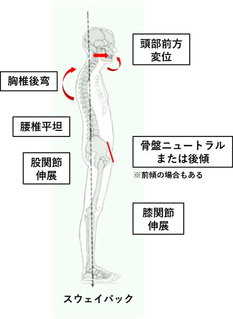 立位姿勢の分類と評価方法 Forpt Online