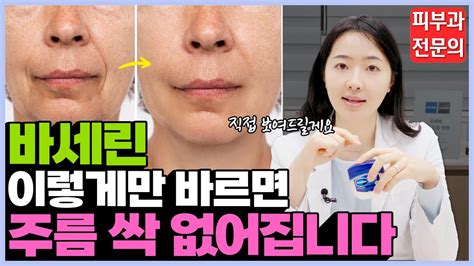 피부과 원장이 말하는 바세린 이런 피부에는 독이 될 수 있어요 피부과 원장이 바세린 효과 올바른 사용법 부작용까지