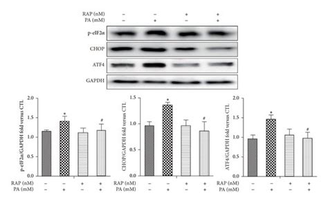 Rapamycin Decreases Pa Induced Inflammatory Cytokines And Er Stress