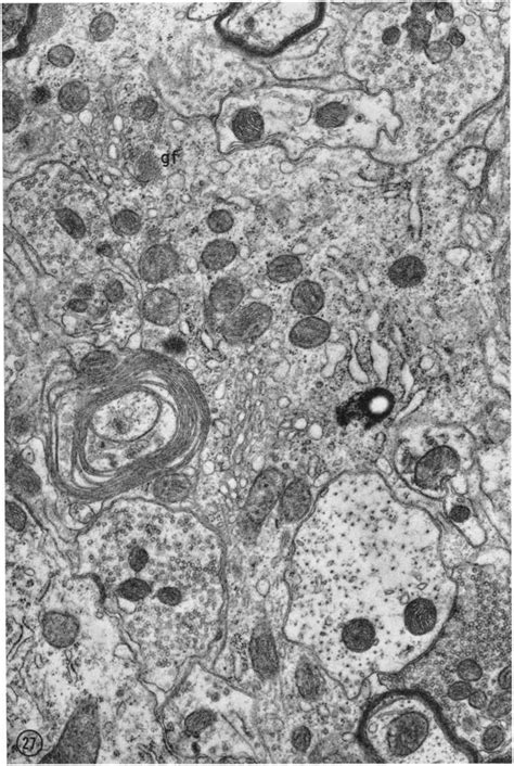 Electron Micrograph Of An Astrocyte Containing Bundles Of Fine