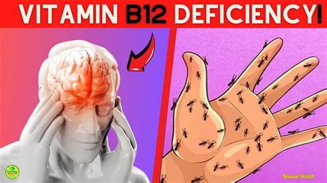 Vitamin B12 Deficiency Symptoms That Should Never Be Ignored Youtube