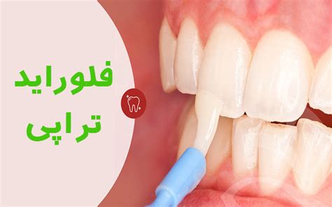 فلوراید تراپی در بزرگسالان و کودکان چگونه است؟ دکتر سیده مریم حاکم زاده