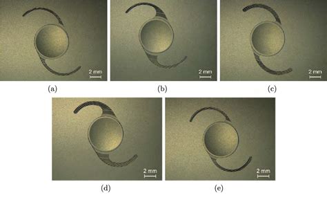 Figure 2 From Effect Of Haptic Geometry In C Loop Intraocular Lenses On