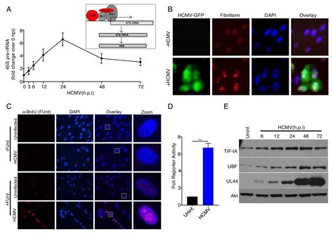 Figures And Data In Ribosome Biogenesis Restricts Innate Immune