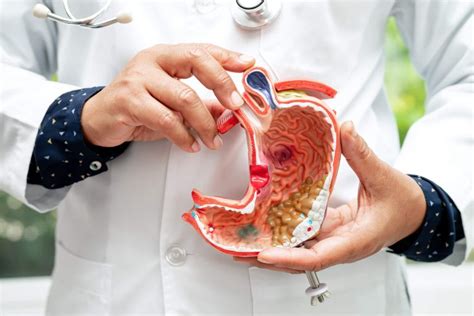 Minimally Invasive Vs Traditional Upper Gi Surgery Precision Upper Gi