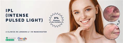 Intense Pulsed Light Ipl Treatment Pulse Light Clinic London