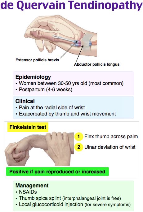 Rapid Review De Quervain Tenosynovitis