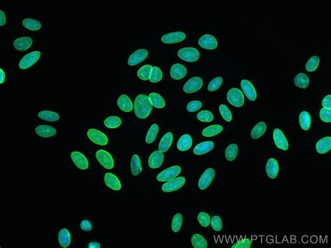 Lamin Ac Antibody 81042 1 Rr Proteintech
