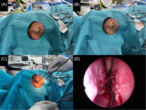 The Overview Of The Procedure With An Assistant Download Scientific Diagram