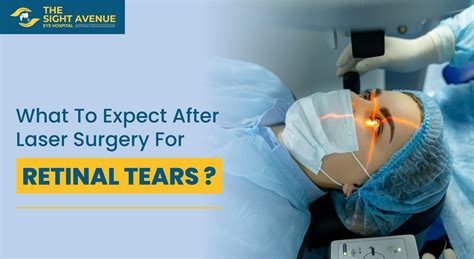 Major Expectations After Laser Surgery For Retinal Tears