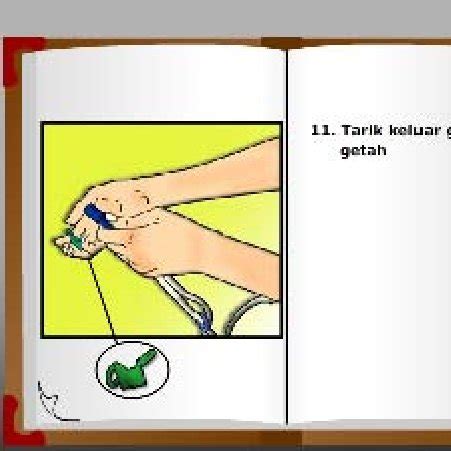 CAPD Procedure Module Download Scientific Diagram