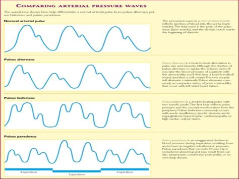 Pulse Abnormal Findings