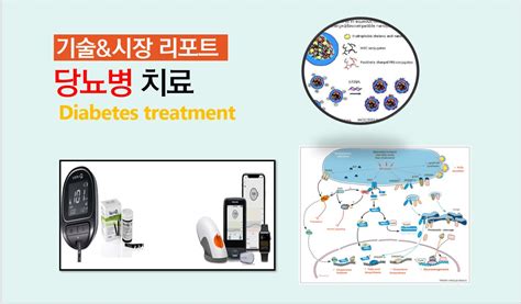 기술 시장 리포트 당뇨병 치료 Diabetes treatment IPTARGETS