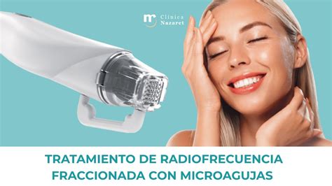 Radiofrecuencia Fraccionada Con Microagujas Tu Tratamiento Estrella