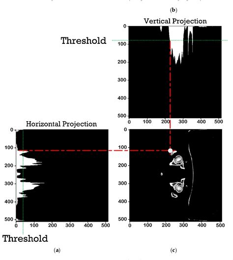 Figure 4 From Enhanced Deep Learning Based Automatic Left Femur