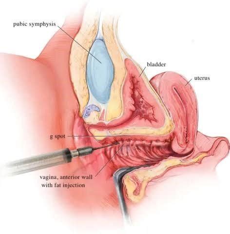 G Spot Enhancement Revita Life Sciences
