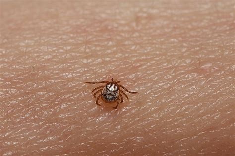 Uso de repelente é uma das prevenções à febre maculosa