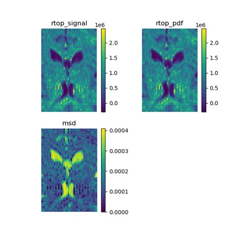 Calculate Shore Scalar Maps — Dipy 1110 Documentation