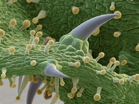 Microorganisms Seen With Sem And Tem Mikroorganismen Im Rem Und Tem