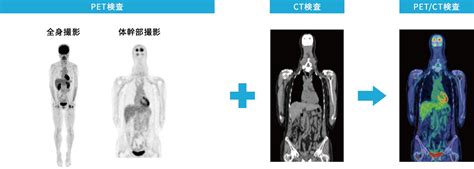 Pet検査について│所沢のpet検査、永仁会シーズクリニック