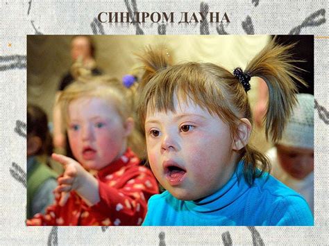 Синдромы связанные с аномалиями в системе аутосом презентация онлайн
