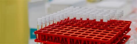 Protoporfiria eritropoietica cauze simptome si opțiuni de tratament