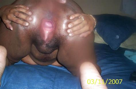 Gaping Hole Porn Pictures Xxx Photos Sex Images 158885 Pictoa