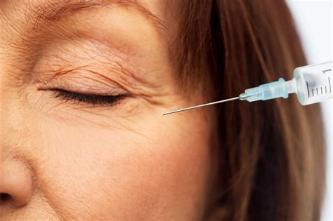 The Benefits Of Dermal Fillers For A Youthful Appearance 7networth