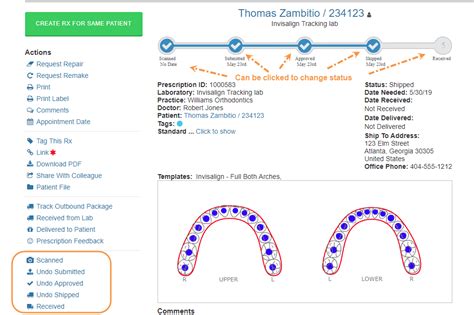 The Enhanced Invisalign Tracking Lab