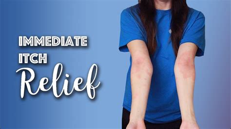 Immediate Eczema Itch Relief Michelle Mills Youtube