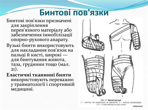 Техніка накладання найбільш поширених повязок презентация онлайн