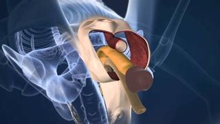 Sex Reassignment Surgery Daftsex