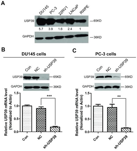 Usp39 Expression In Pca Cell Lines And The Silencing Efficiency Of