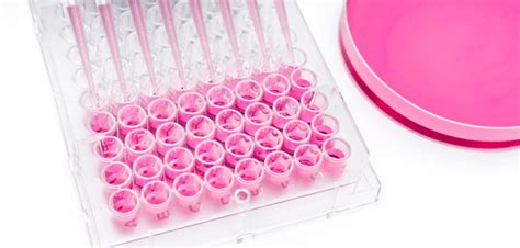 In The Zone The Importance Of Monitoring Assay Performance And