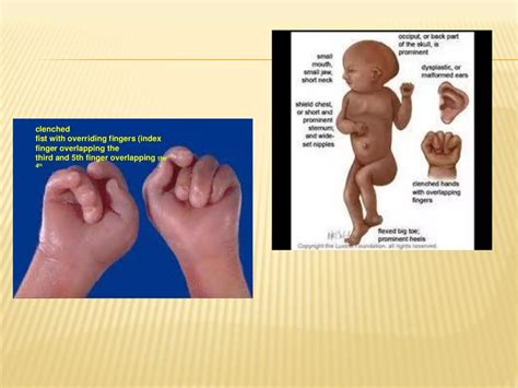 Heredity Inheritance And Variation Pdf Biological Sciences Science