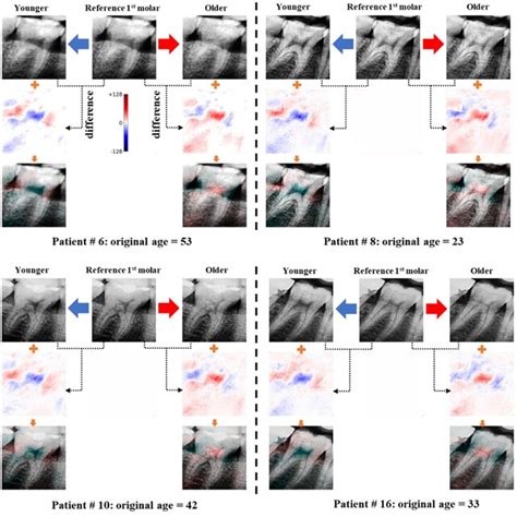 An Example Of Color Maps Representing The Correlation Between Advancing Download Scientific