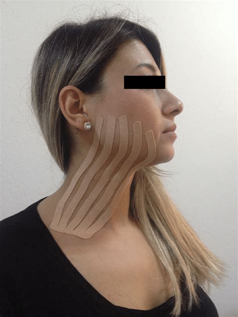 Clinical Application Of Kinesio Taping Download Scientific Diagram