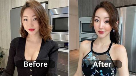 Yeonmi Park Surgery Before And After All You Need To Know Weight Loss
