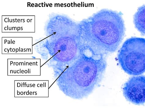 Mesothelium Wikiwand