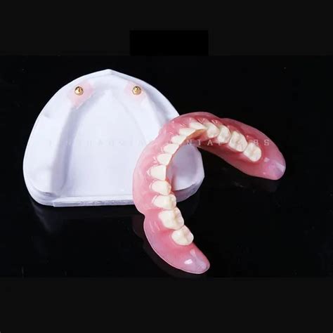 Dental Prescision Attachments Retained Removable Partial Dentures