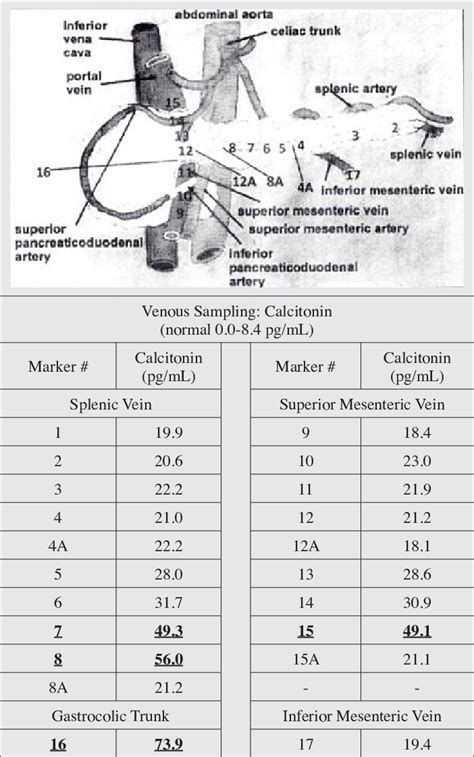 Results Of Trans Hepatic Portal Vein Sampling For Serum Calcitonin Download Scientific Diagram