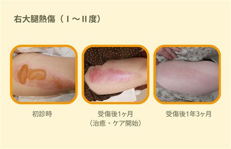 病名