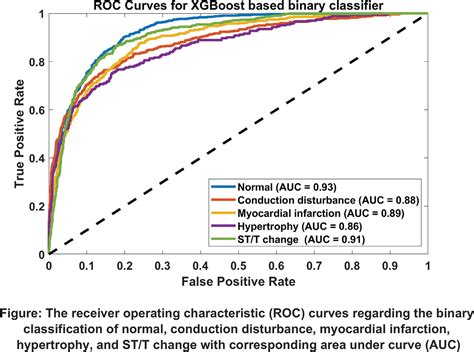 Autonomous Detection Of Myocardial Infarction And Other Ecg